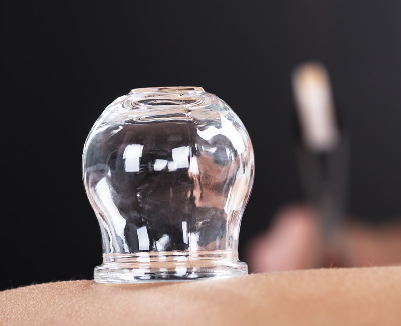 Essence Acupuncture & Wellness | Best Acupuncture San Antonio | Cupping ...